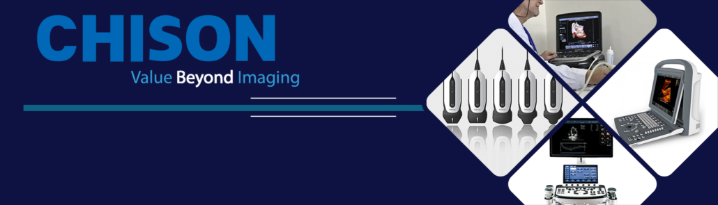 Diagnóstico por imagen con Ecógrafos Chison de última generación